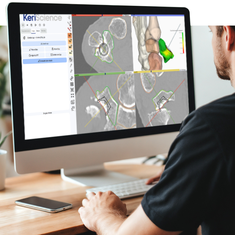 KeriMedical | Hand & Wrist Implants, CMC & Wrist Prostheses